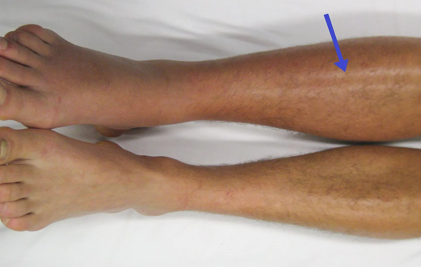 Repaso Final: Clínica Médica